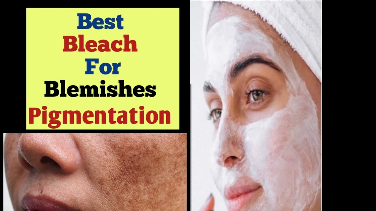 The Secret to Clear, Spotless Skin |Best Face Bleach Revealed - YouTube