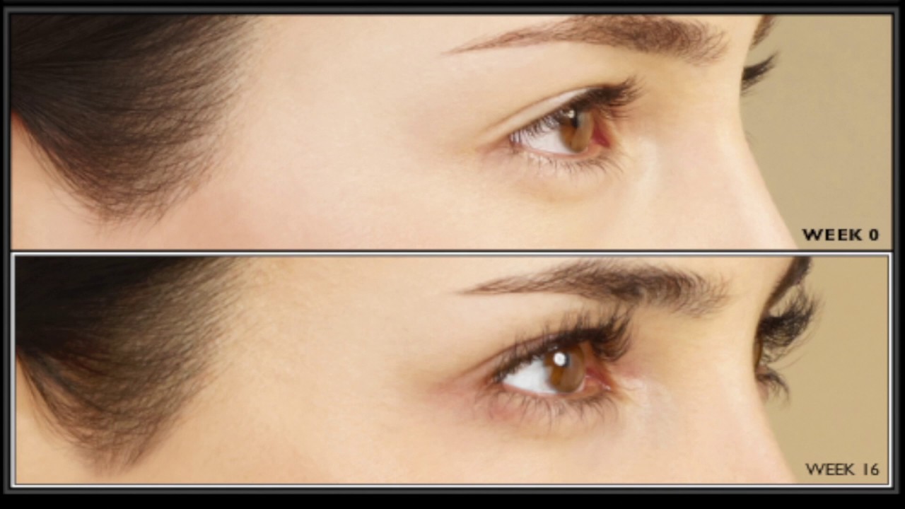 How does Latisse work for longer eye lashes? - YouTube