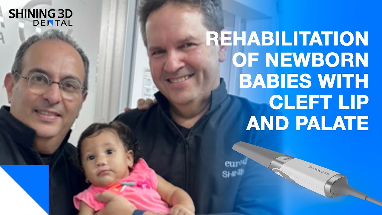 Rehabilitation of Newborn Babies with Cleft Lip and Palate - YouTube