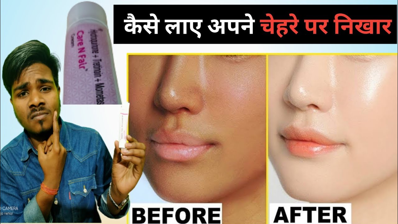 10दिन में गोरा | care N fair Fairness Cream For Men | Gora Hone Wala ...