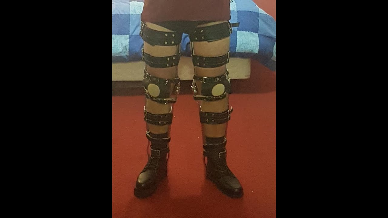 Traditional Metal/leather KAFO's from My Care Prosthetics & Orthotics ...