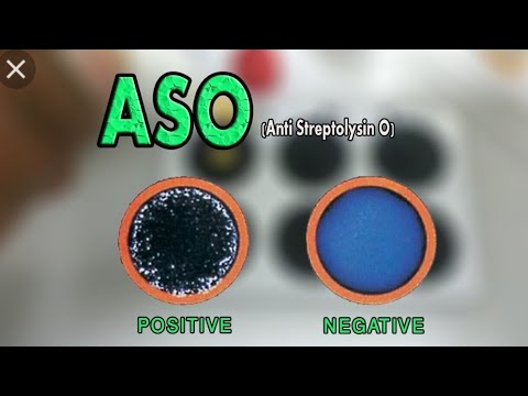 A S O test antistreptolysin test - YouTube