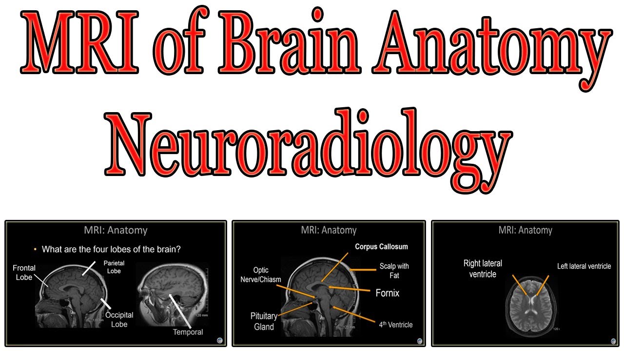 Mri Brain Anatomy Ppt