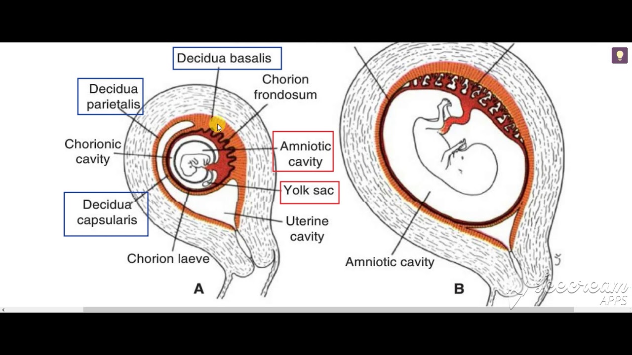 Chorion Decidua Placenta 2 - YouTube