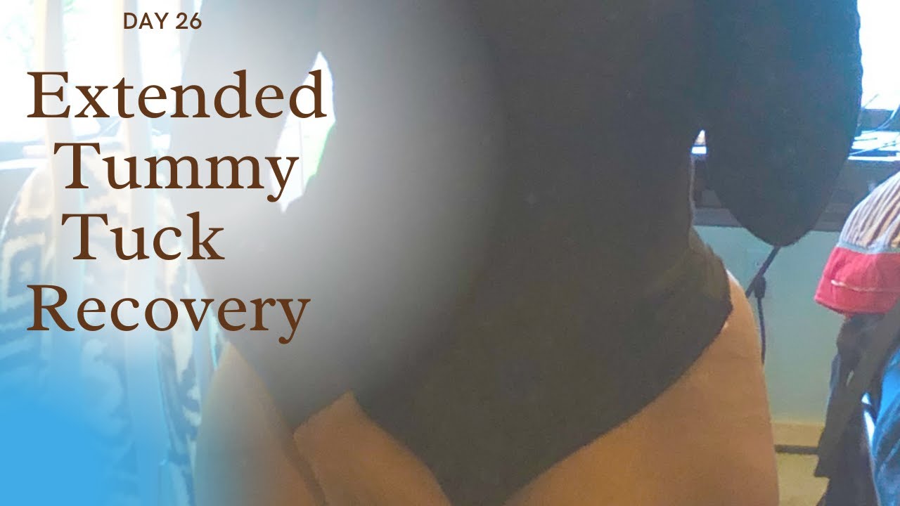 Tummy Tuck Vlog Post Op Day 26 Youtube
