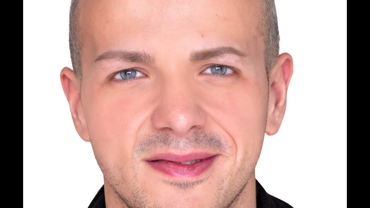 Changing Eye Color WITHOUT implant, with the NEORIS technique: Aqua ...