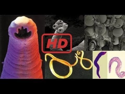 Science Documentary 2017 | Deadly PARASITES Eating us Alive - National ...