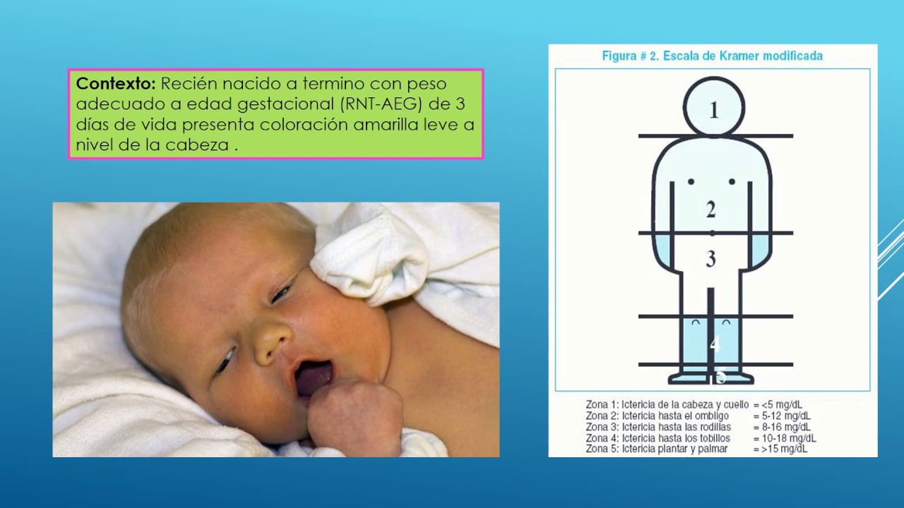 Escala de Kramer en Recien Nacidos - YouTube