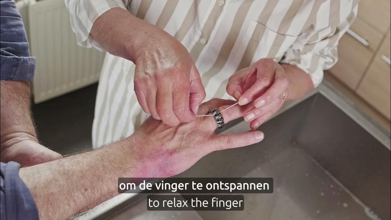 Ring verwijderen - YouTube