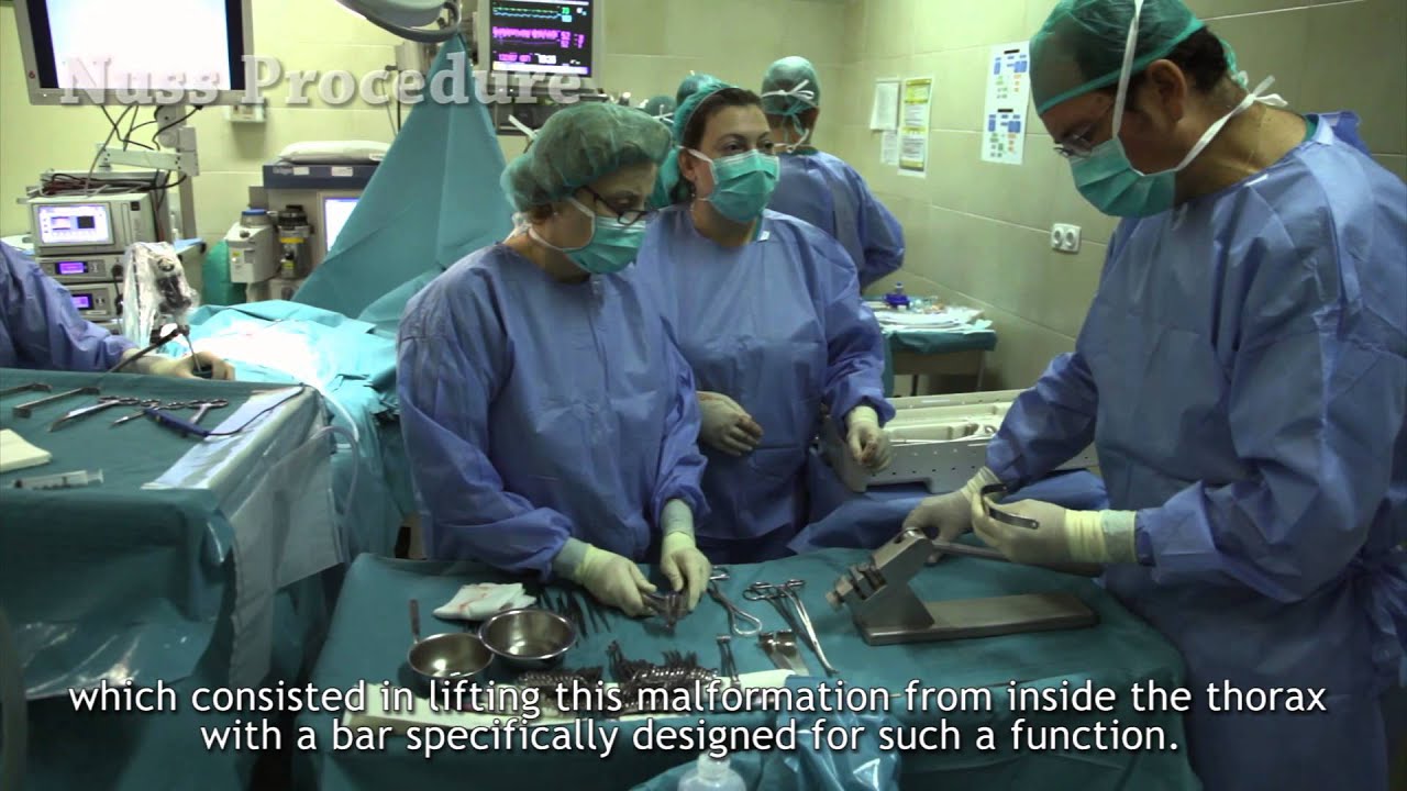 Pectus excavatum treatment: Pectus Up & Taulinoplasia | Ventura Medical ...