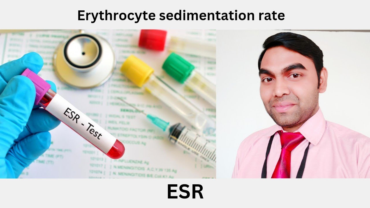 Erythrocyte sedimentation rate!!ESR!!wintrobe!! Westergren methods ...