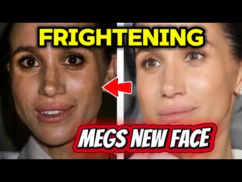 What’s going on with Meg’s face?!?! - YouTube