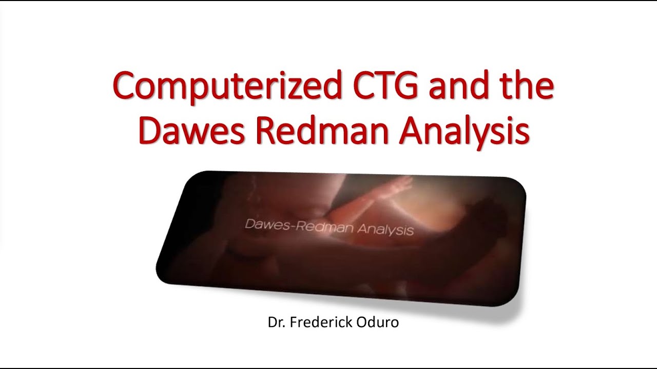 Computerized CTG - YouTube