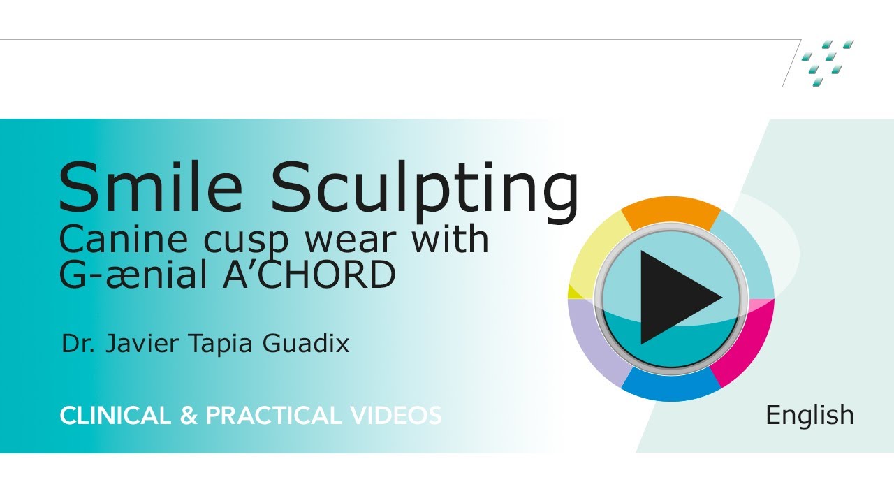 Smile Sculpting: canine cusp wear with G-ænial A'CHORD (short version ...