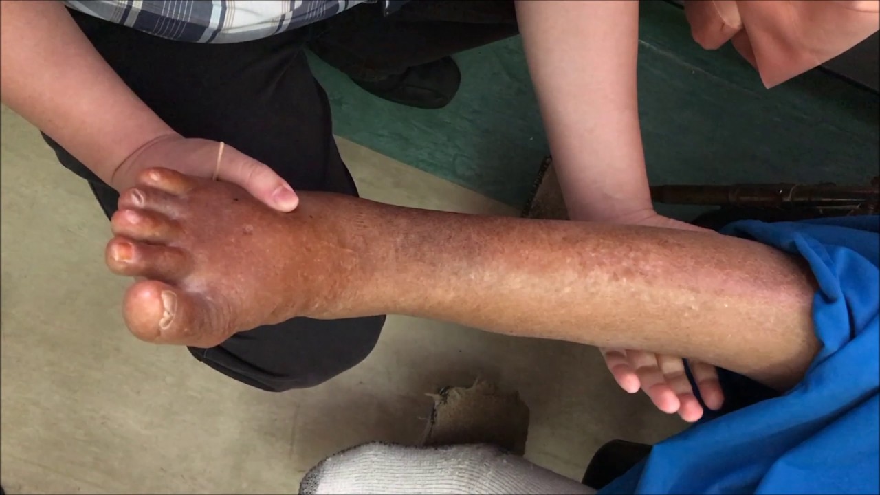 Gordon Sign - YouTube