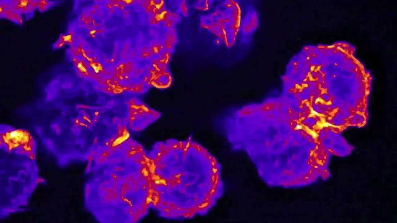 IMB awarded $2.3M to establish ACRF Cancer Ultrastructure and Function ...