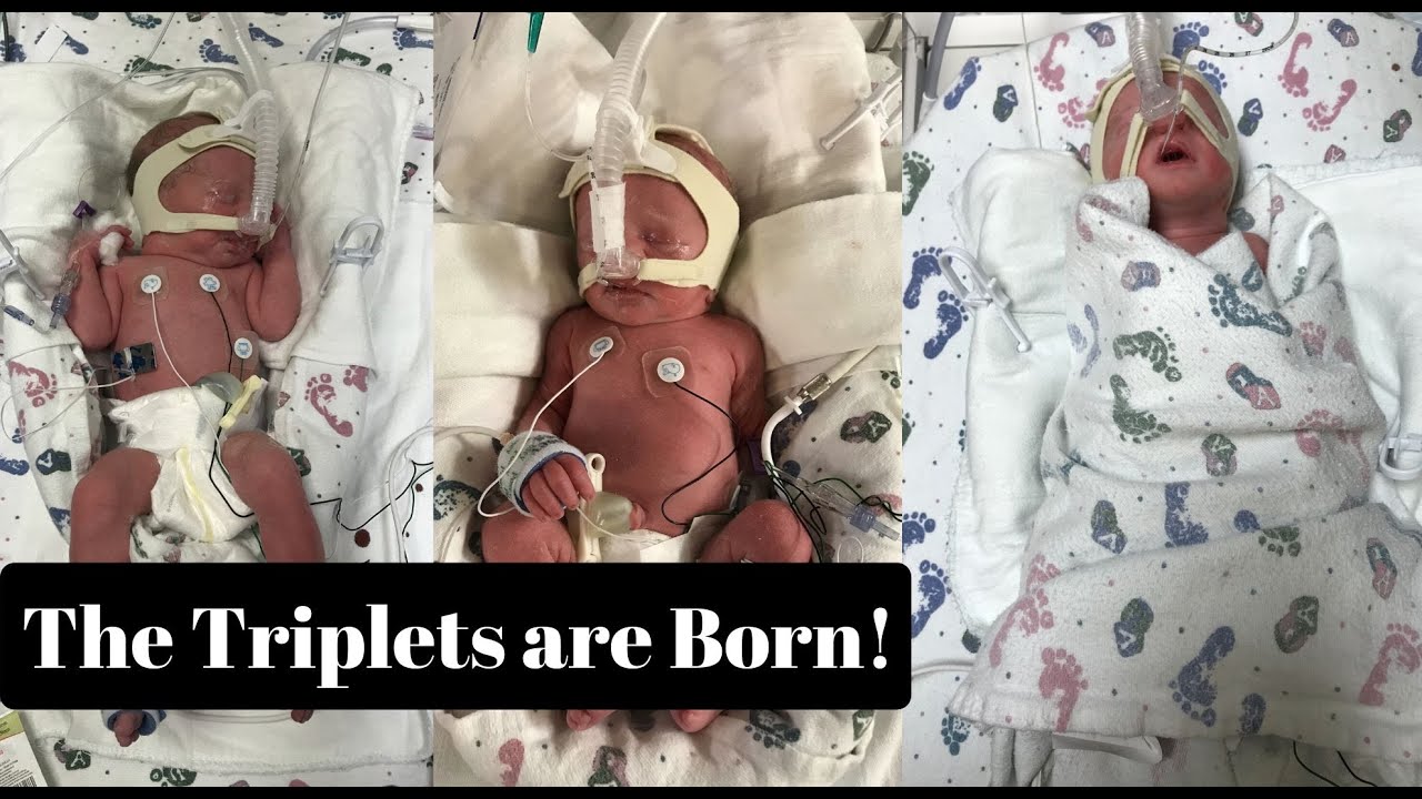 Triplets Preterm Labor, Delivery, and NICU Stay | Triplet Pregnancy and ...