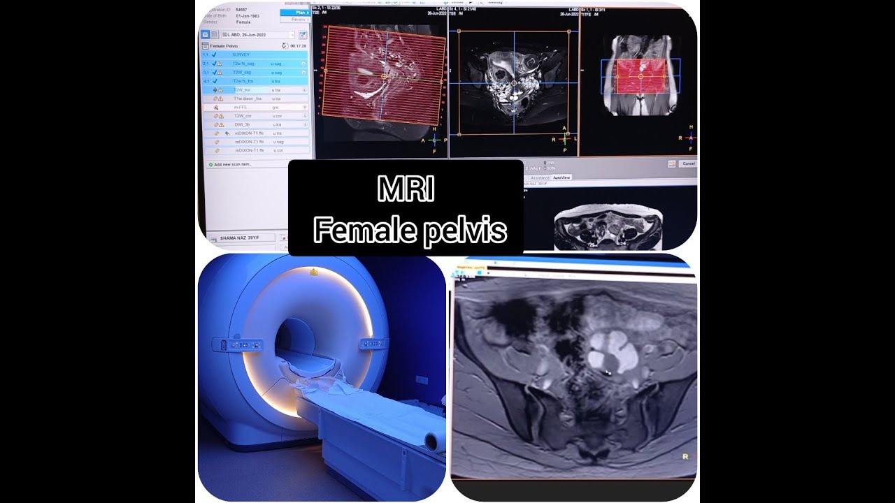 MRI Female pelvis planning and positioning - YouTube