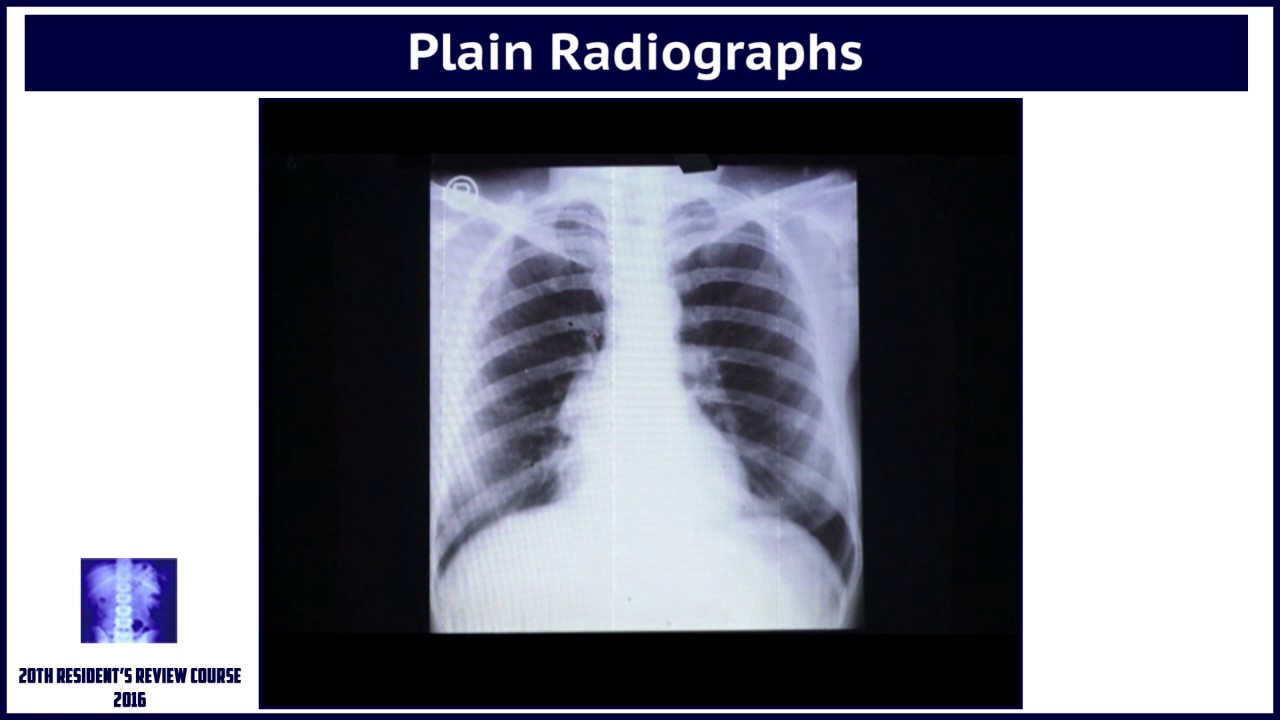 1 Plain Radiographs TRAILER - YouTube