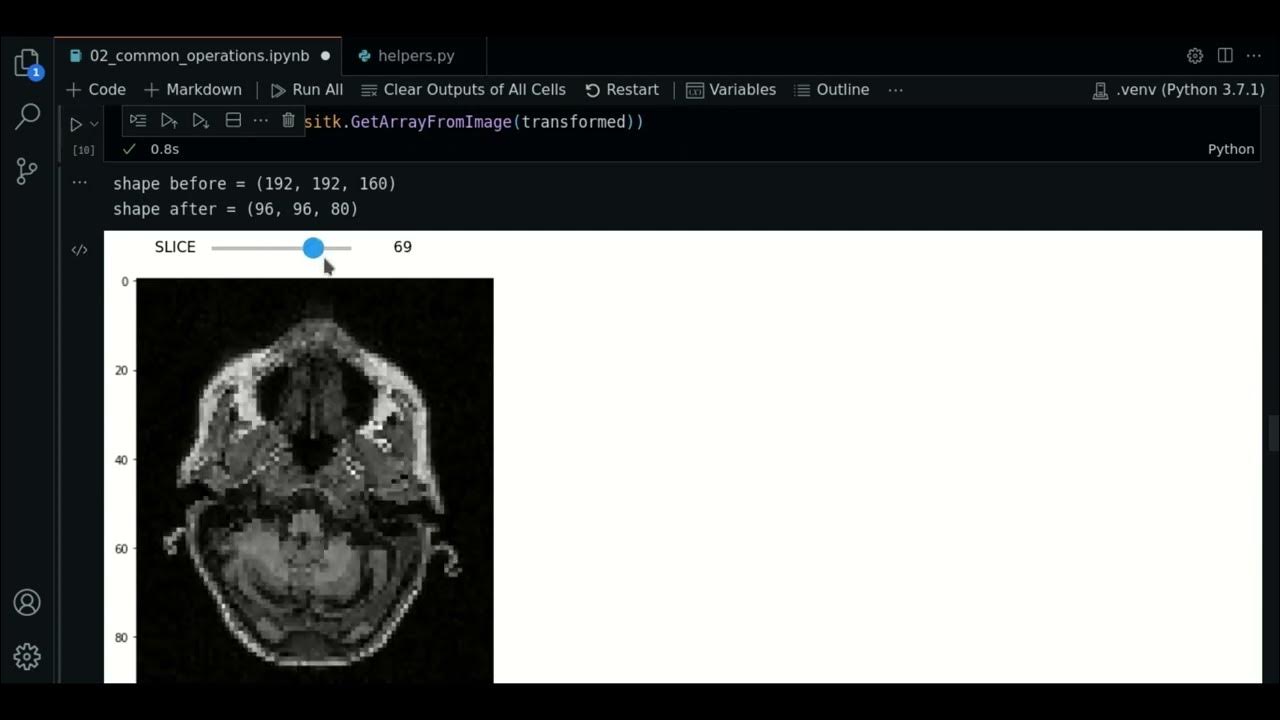 2.1 - Shrink | SimpleITK - Course MRI preprocessing with Python - YouTube