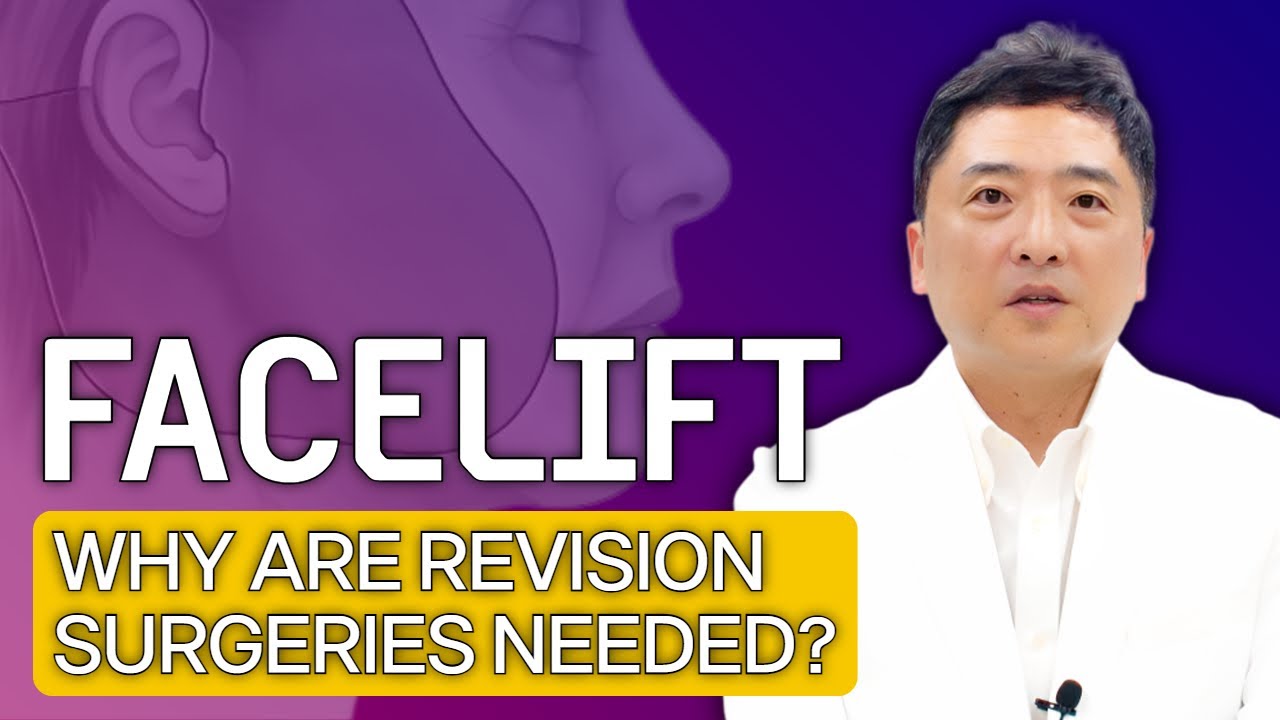 Facelift Surgery: Why Are Revision Surgeries Needed? - YouTube