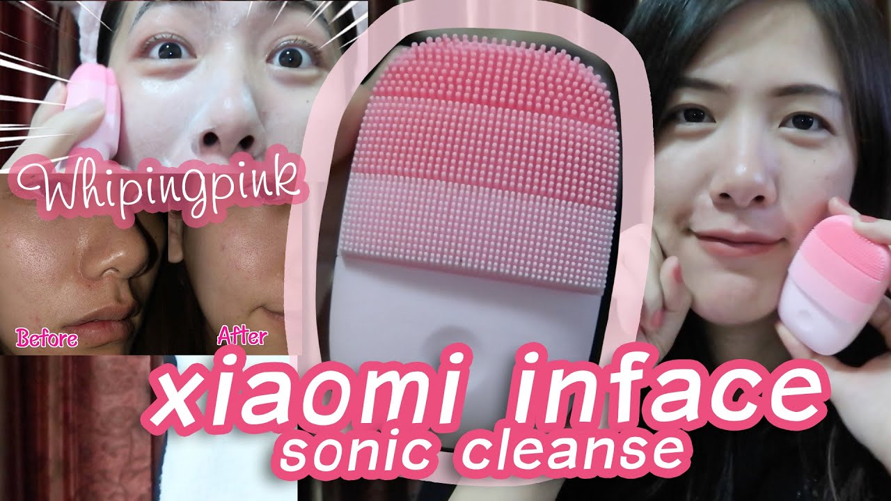 xiaomi inface รีวิวใช้จริง 1 เดือน Ep.1 (มีต่อEP.2 ใช้4 เดือนนะจ๊ะ) สิว ...