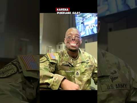 PERBEDAAN WAJAH TENTARA SETELAH PERANG part 4