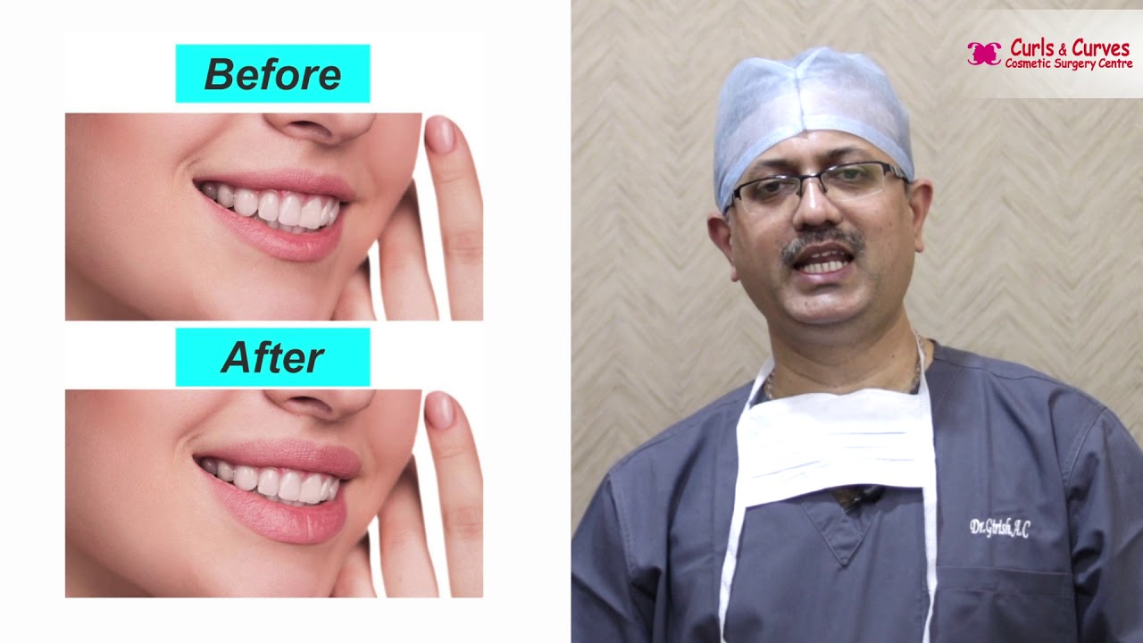 Facial Cosmetic Surgery In Bangalore | Dr.Girish A C - Curls and Curves ...