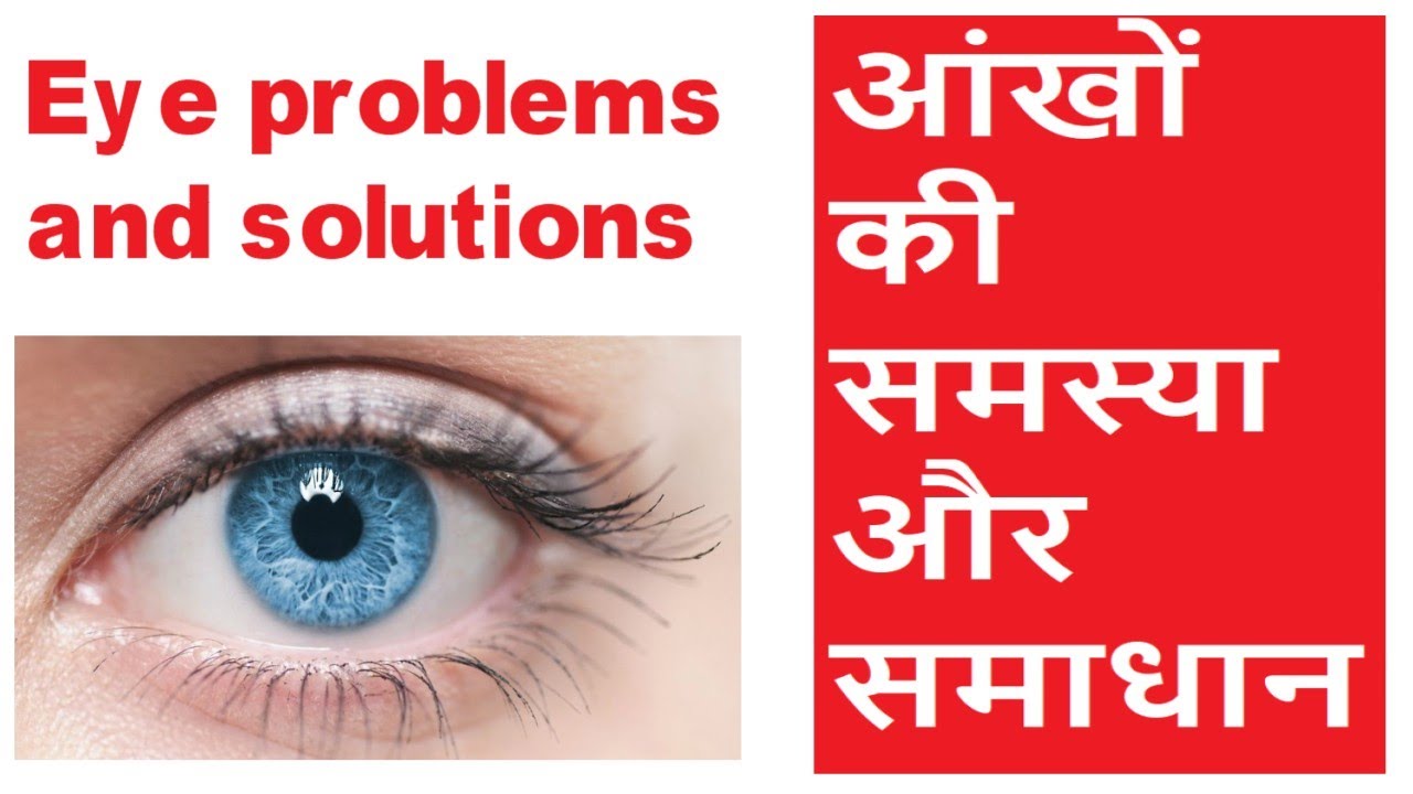 Eye Problems And Solutions In Hindi eye-problems-and-solutions-in-hindi