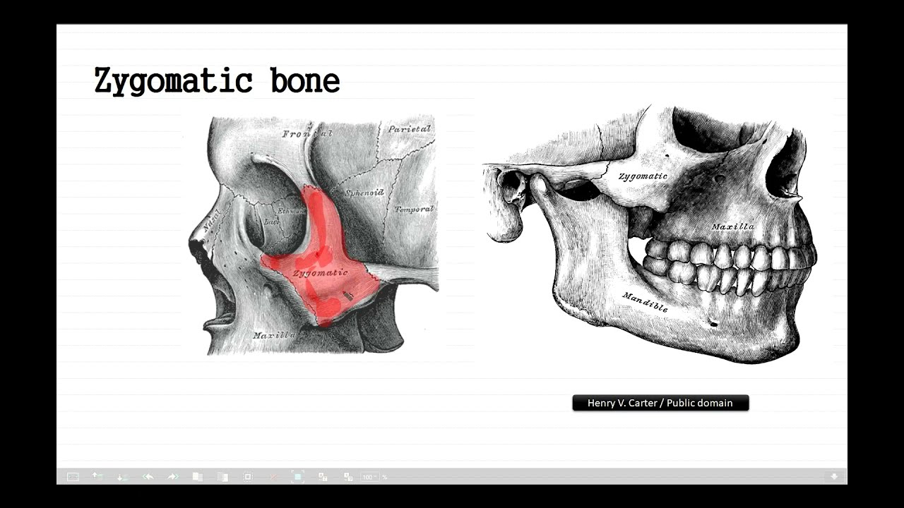광대뼈 zygomatic bone 관골 - Individual bones of Skull, SNUSD Knowledge ...