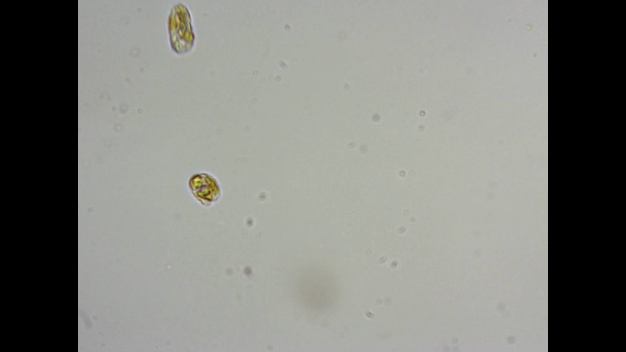 Ochromonas - YouTube