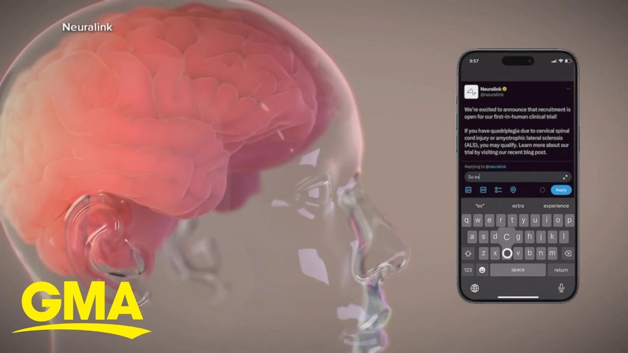 Neuralink claims 1st brain-chip patient can play chess - YouTube