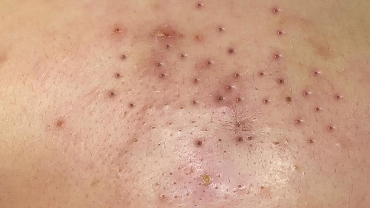 Satisfying Relaxing with Sac Dep Spa Video (#144) - YouTube