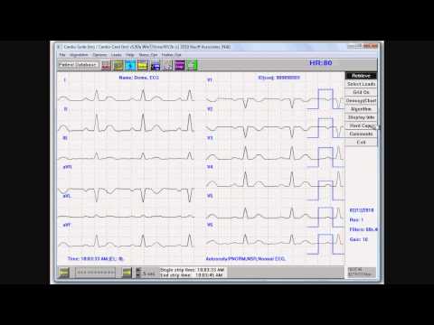 How to Print an ECG - YouTube
