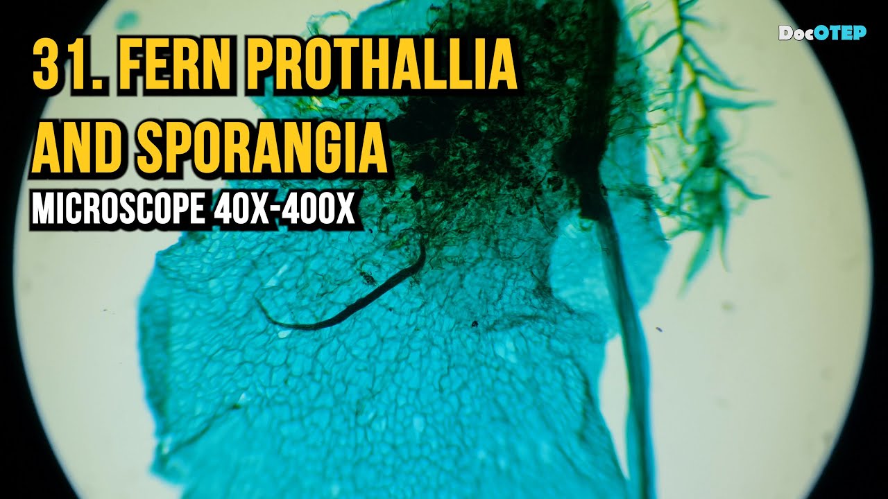 31. Fern Proth and Sporangia (Microscope 40x-400x) - YouTube