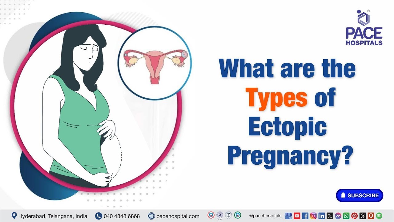 Type of Ectopic Pregnancy | What are the Types of Ectopic Pregnancy ...