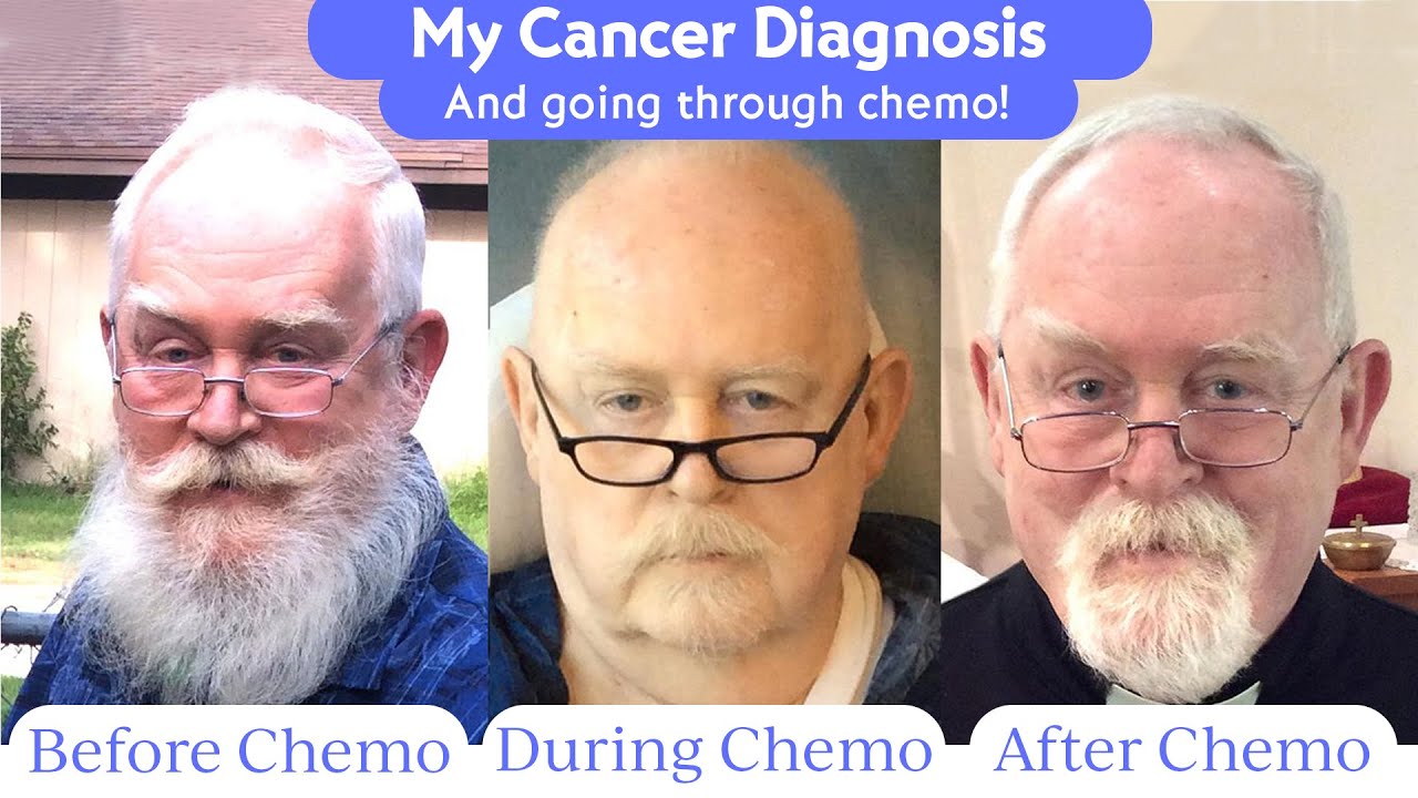 Cancer Patient Story: My 1st Symptoms, Tests & Diagnosis (Blood Cancer ...