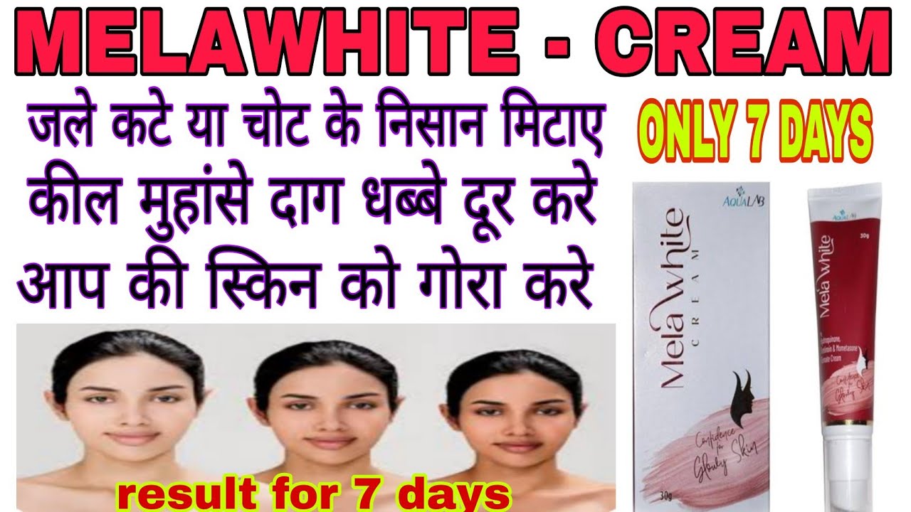 Mela white cream review in hindi/Remove acne pimpale dark circles कील ...