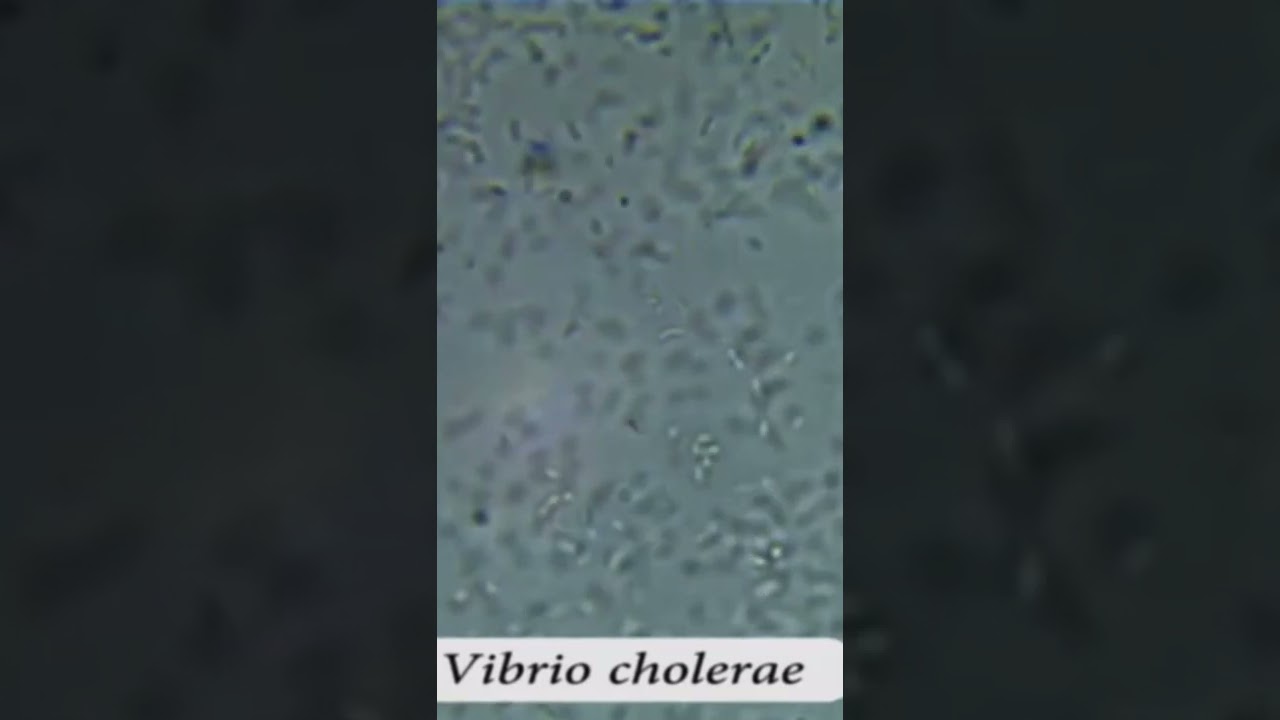 Darting Motility In Vibrio cholerae |Jitendra Kumar| #neetpg #inicet # ...