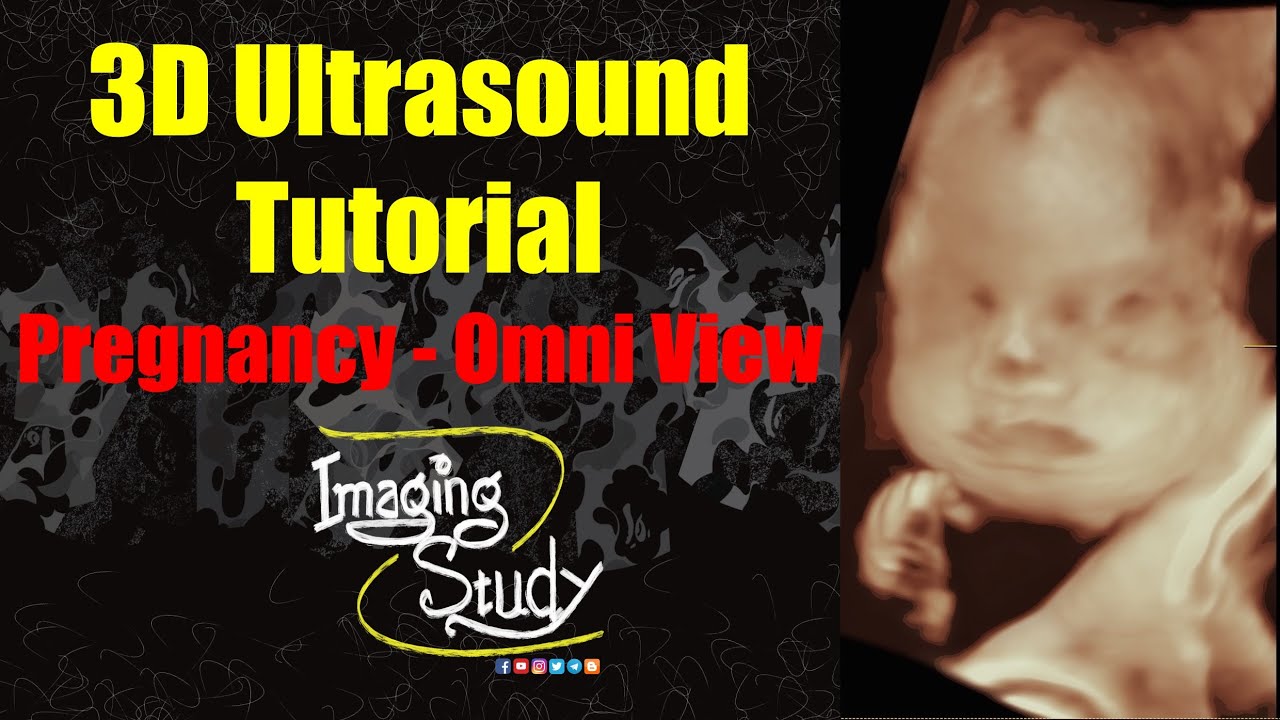 3D Ultrasound Tutorial: Pregnancy | Omni View - YouTube