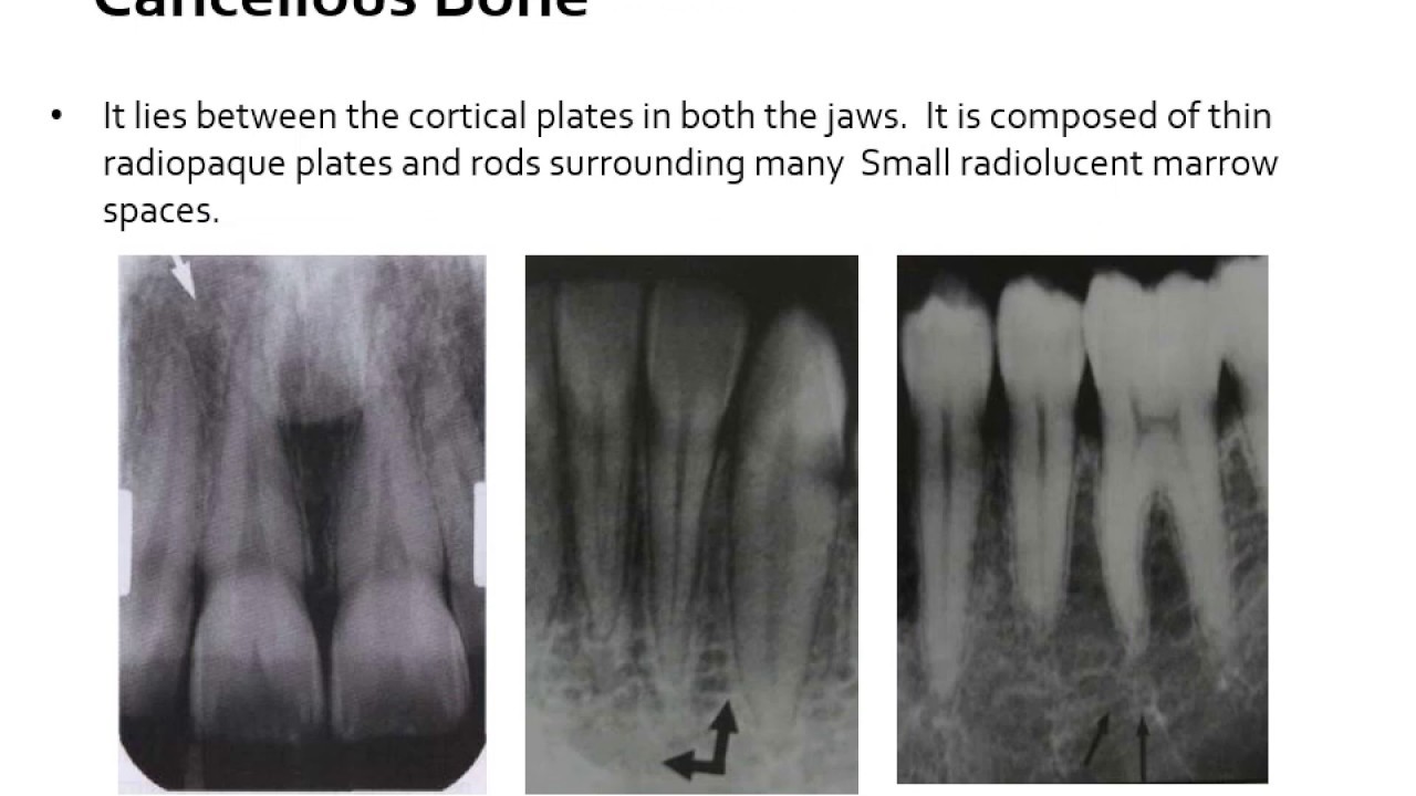 Normal Radiographic Anatomical Landmarks Youtube