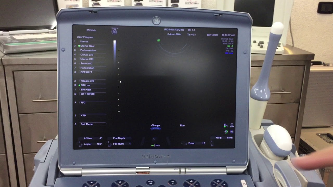 ge Voluson e control panel part 2 - YouTube