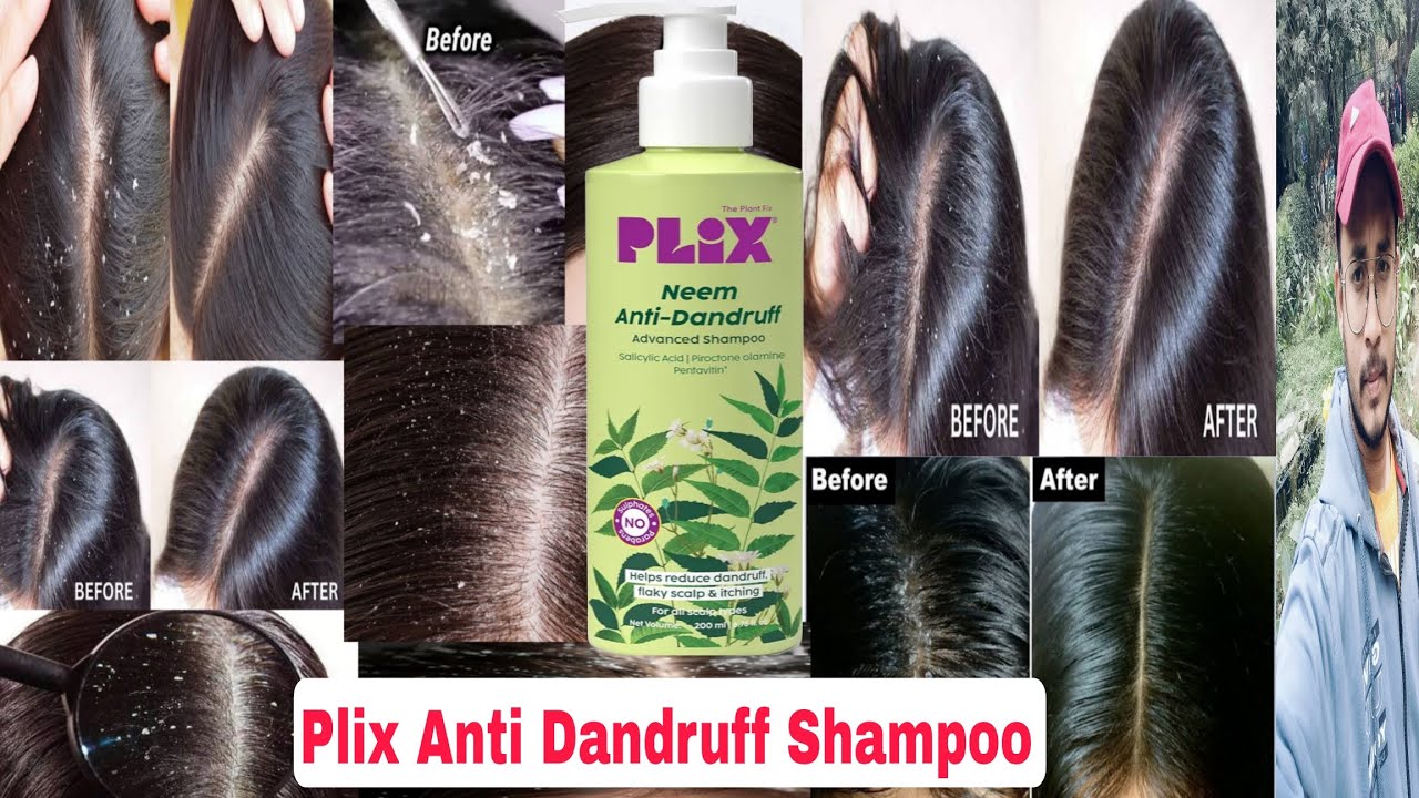 Plix Anti Dandruff Shampoo Review - YouTube