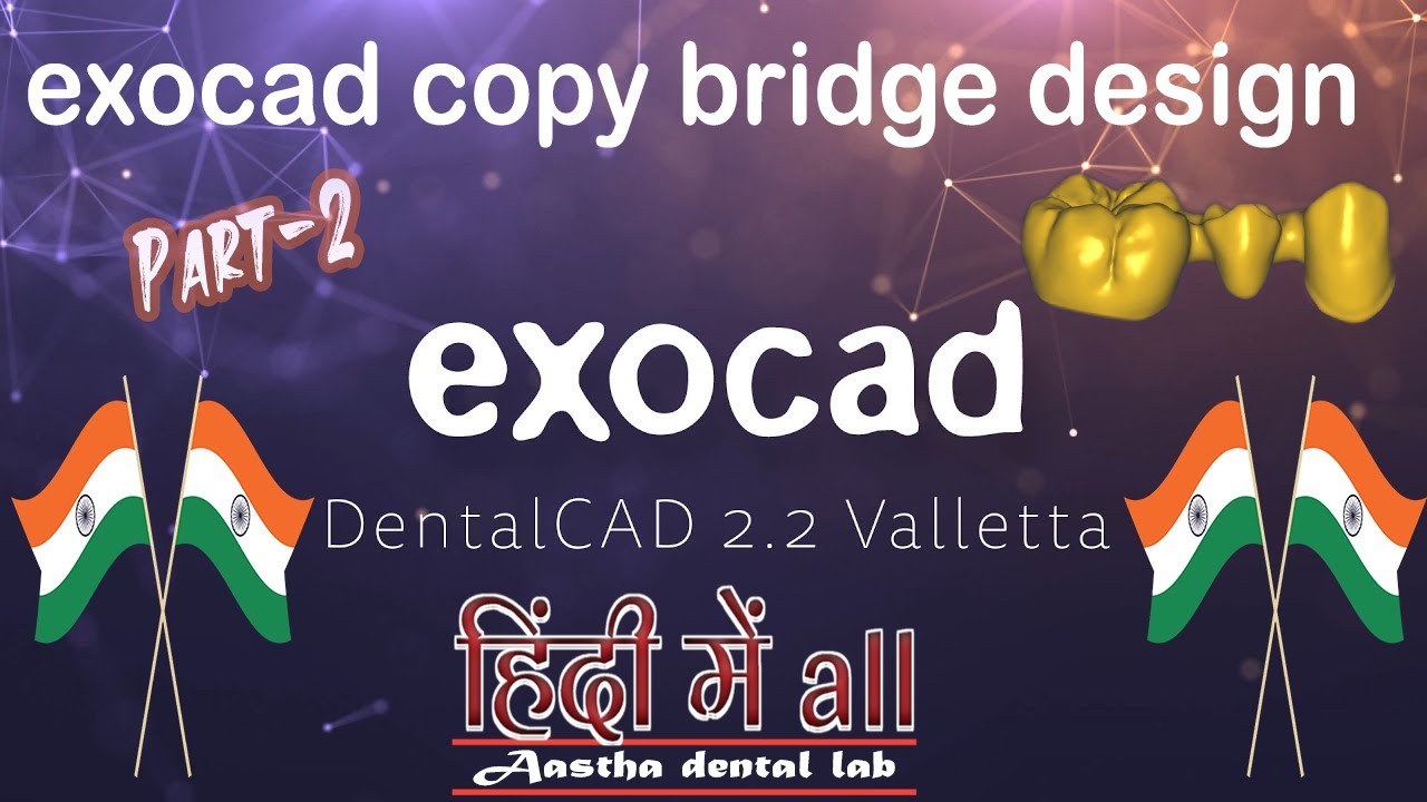 exocad bridge design || exocad crown design || exocad bar design ...