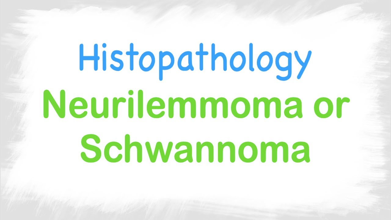 Neurilemmoma or Schwannoma histopathology features - YouTube