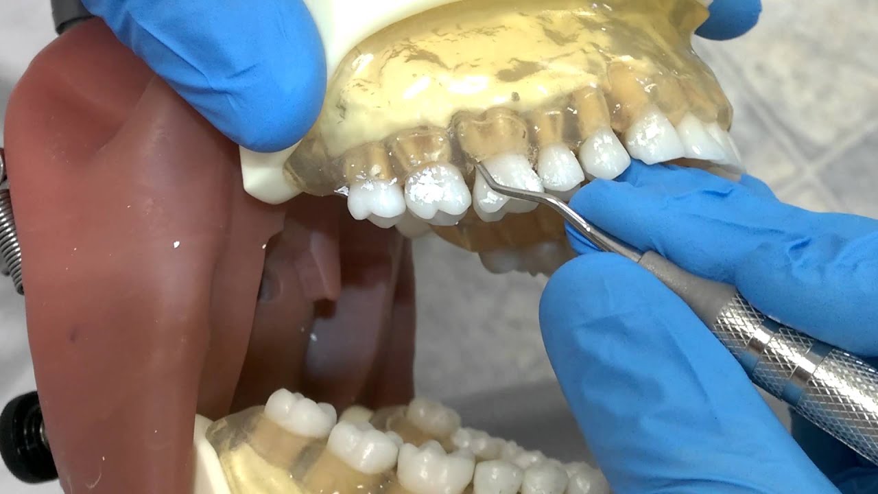 Gracey Instrumentation Basics YouTube gracey-instrumentation-basics-youtube