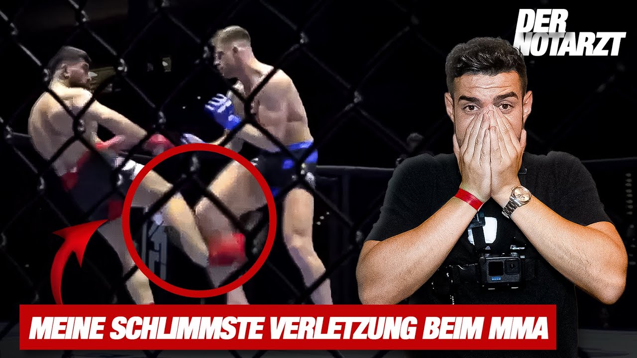 UNTERSCHENKELBRUCH im MMA & So bereite ich mich als Arzt auf RCS 5 vor ...