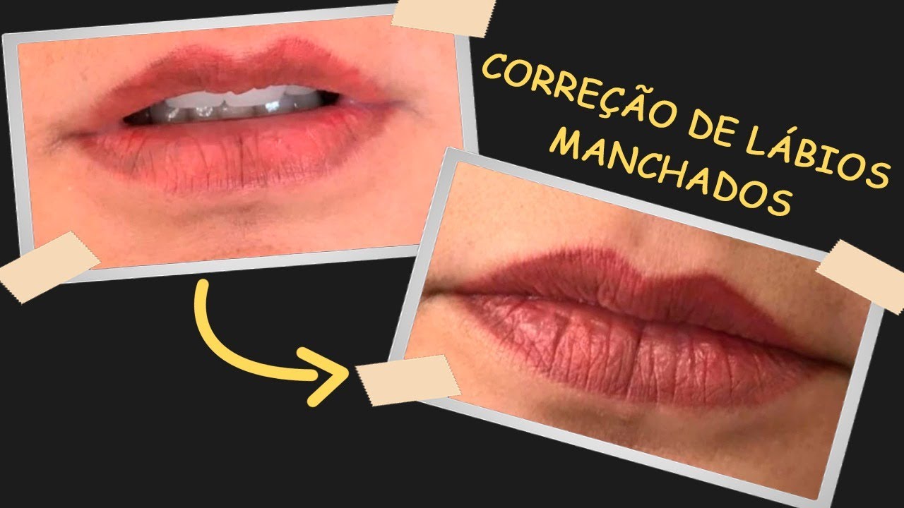 LÁBIOS MANCHADOS NA MICRO. COMO CORRIGIR? - YouTube