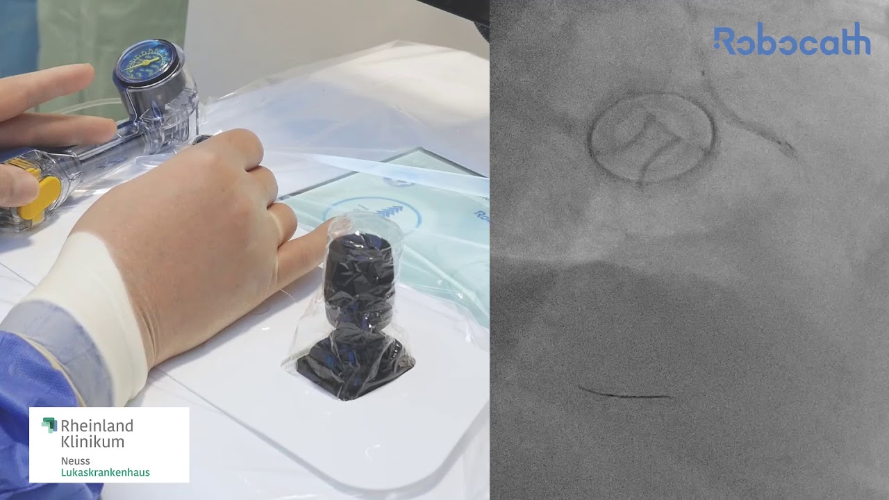 Robocath First cases in Germany - ROne - YouTube