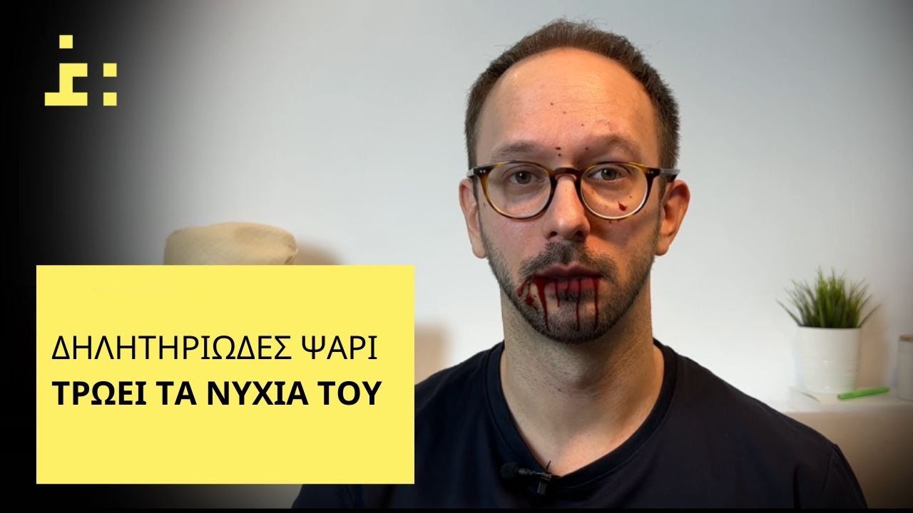 Πώς να μην Τρως τα Νύχια Σου; - Θεμιστοκλής Τσίτσος | Φαρμακοποιός ...